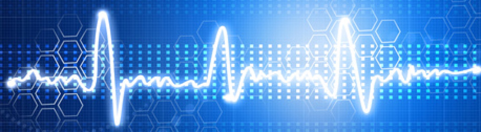 Signal & image processing: Getting from analogic to digital | Scilab Signal & image processing: Getting from analogic to digital | Scilab
